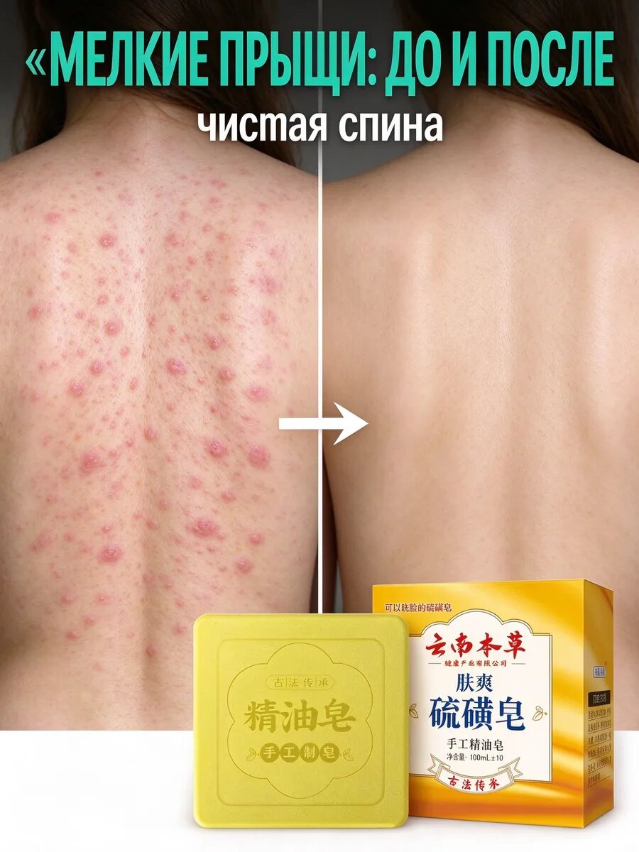 Серное мыло для подростков 100г