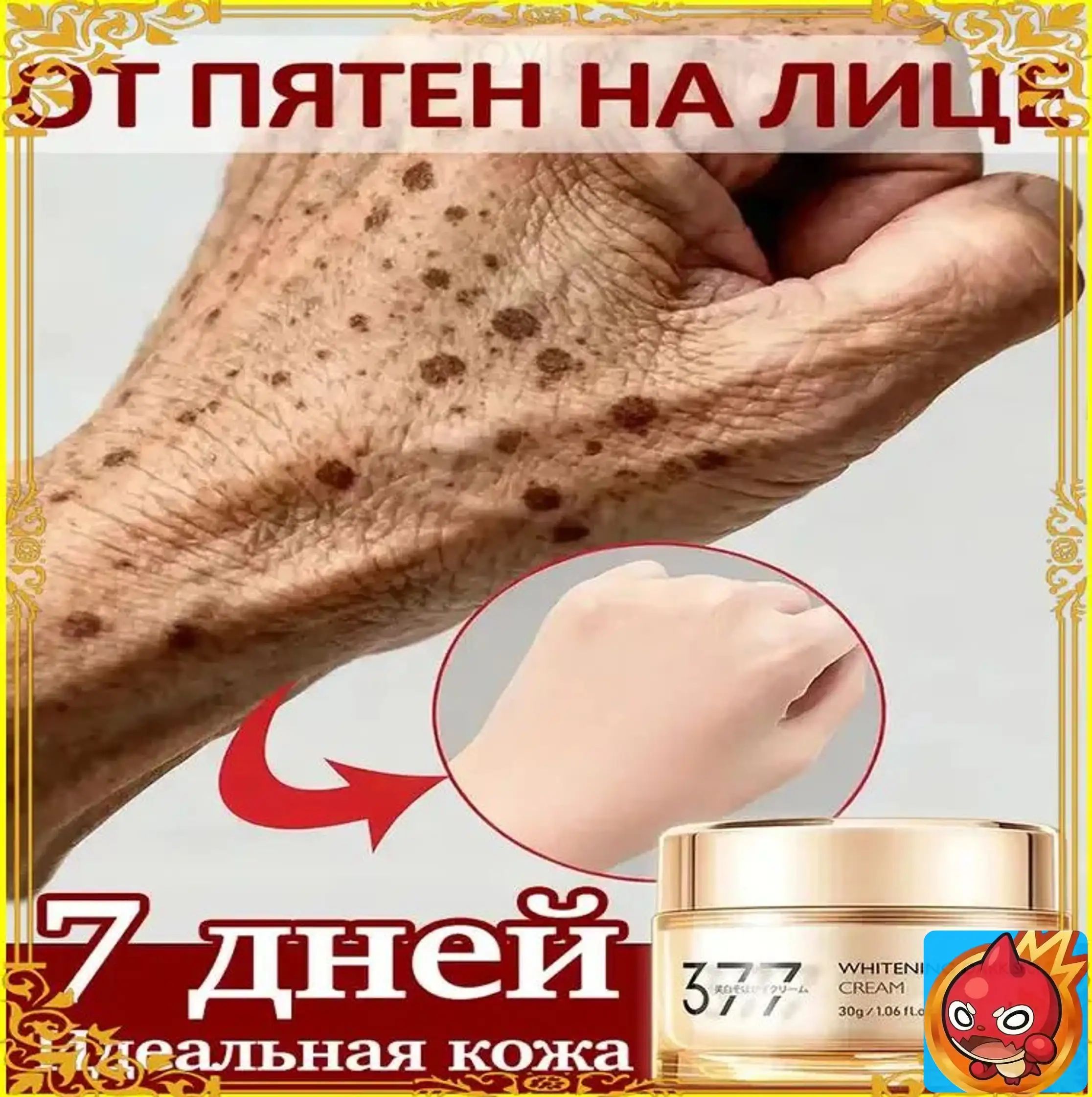 Крем от пигментации для лица, удаляет пигментные пятна, против пигментации, осветляет, для мужчин и женщин, 30 г,