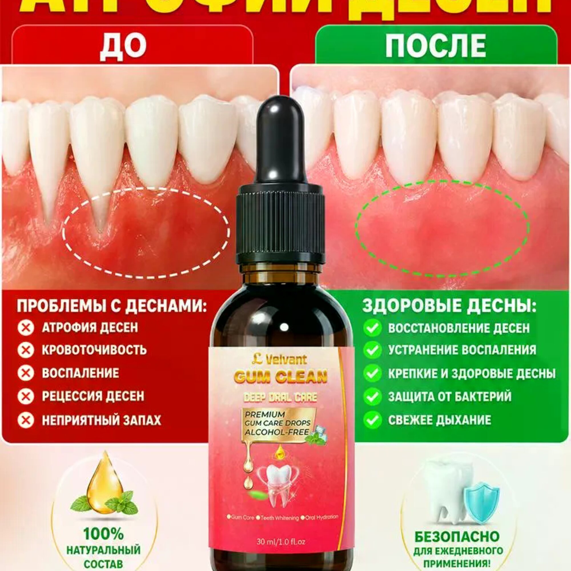 Капли для полости рта Gum Clean для здоровья дёсен, 30 мл, с пипеткой, без спирта, натуральный состав, уход за дёснами