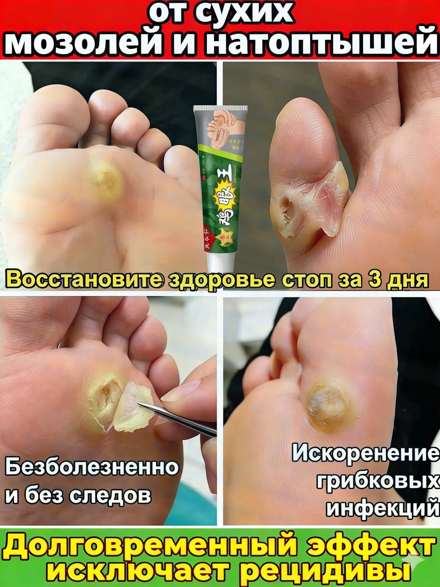Крем от мозолей на мизинце