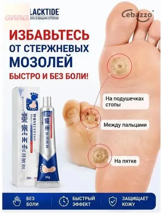 Средство от шипиц, натоптышей и сухих стержневых мозолей на ногах мазь и гель Корнекс, эффективное китайское средство