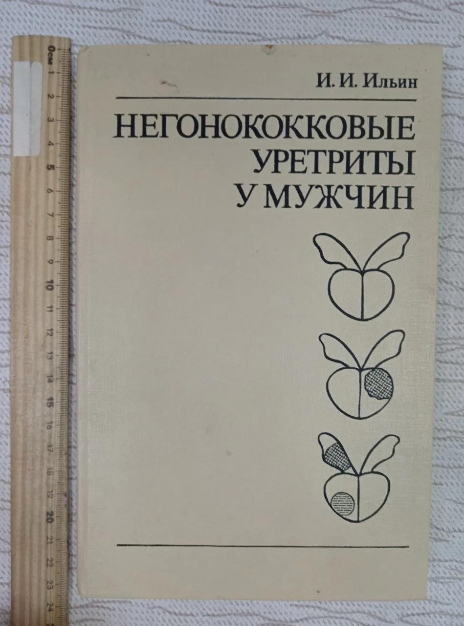 Негонококковые уретриты у мужчин