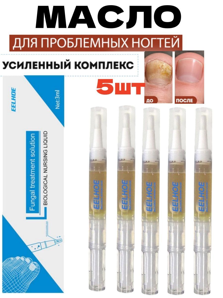 Противогрибковый лак для ногтей, Унисекс, Для лечения онихомикоза, Эффективный, не вызывающий раздражения