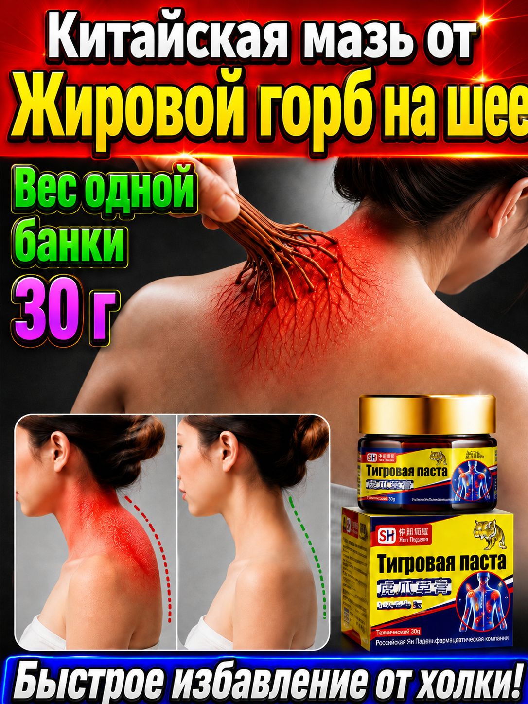 Мазь от холки на спине китай, вдовьего горба на шее, Помогает вылечить при шишке на шее, сдавлении нерва, боли и припухлости, мазь от остеохондроза шеи и спиныАнальгетики