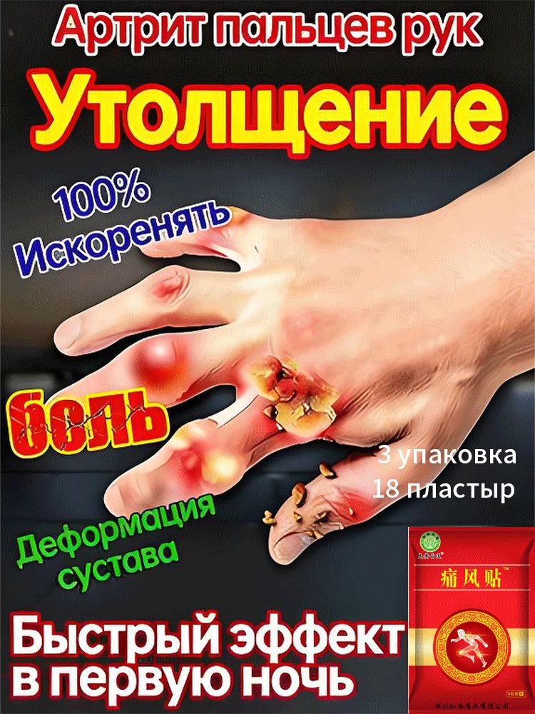 Мазь от подагры, Устранение боли при артрите, коленях, пальцах ног и т. д, на ноге и для рук и артрита