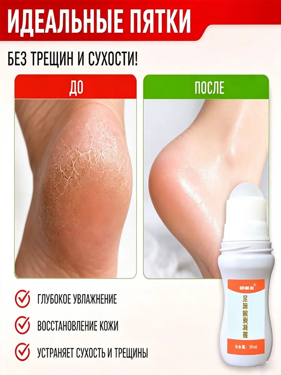 Мазь с мочевиной 30% для пяток и огрубевшей кожи