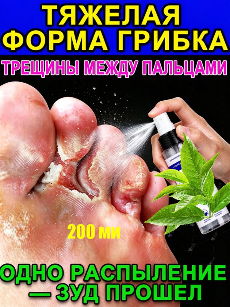 Спрей от грибка стоп/противогрибковое средство для ног и обуви