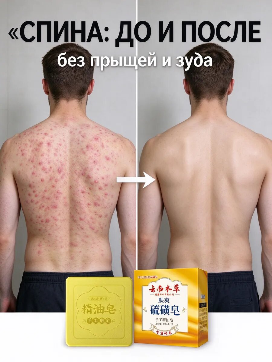 Мыло серное от перхоти 100г
