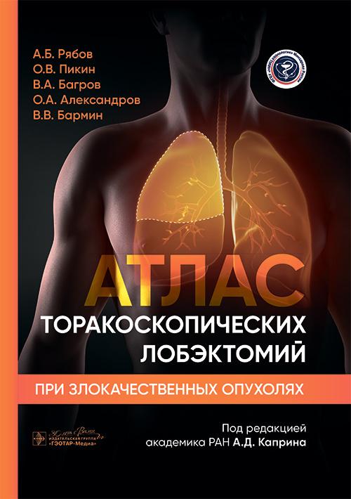 Атлас торакоскопических лобэктомий при злокачественных опухолях / А. Б. Рябов, О. В. Пикин, В. А. Ба