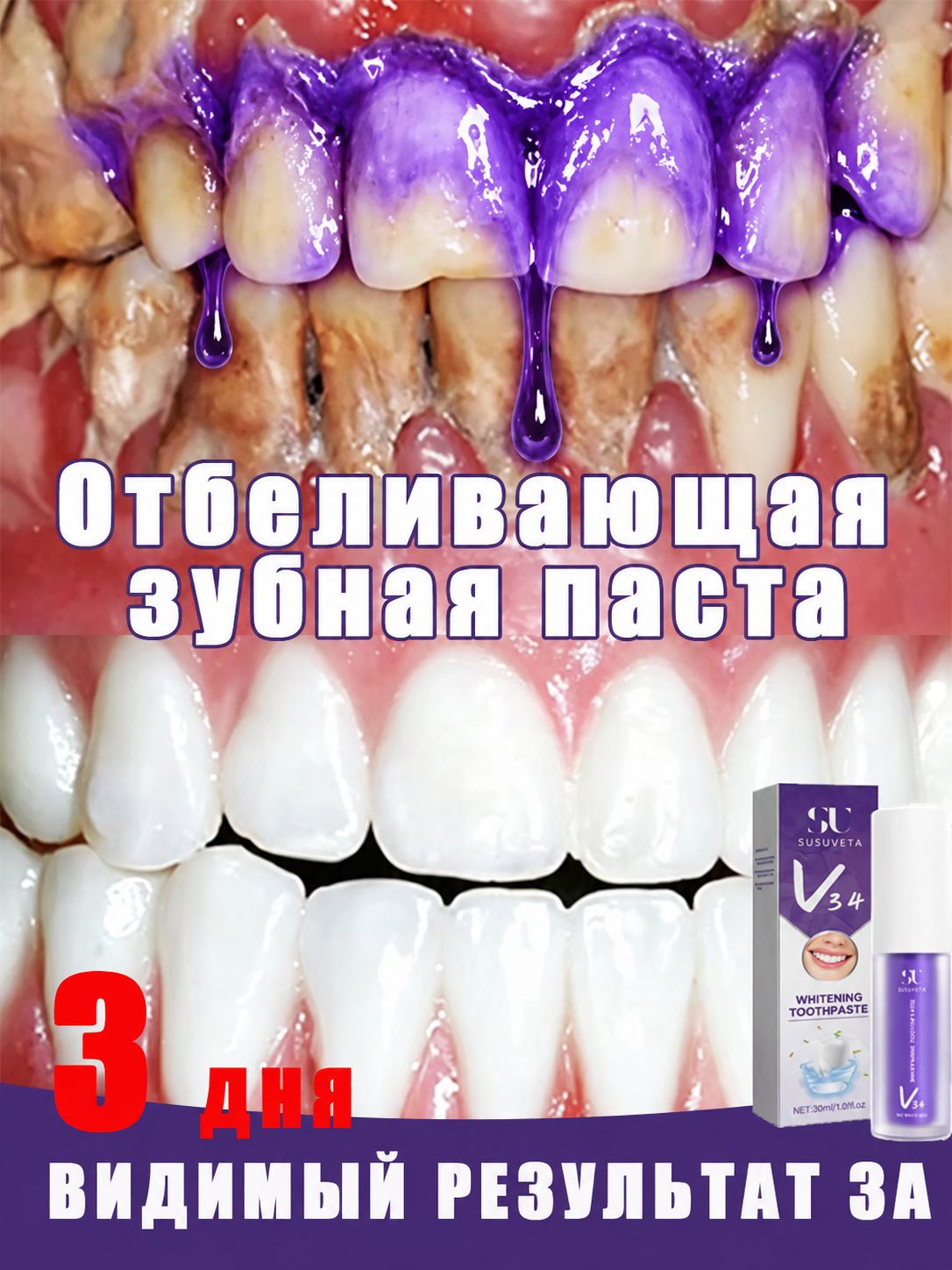 Отбеливающая зубная паста: результат уже через 7 дней. Эффективно удаляет стойкий зубной налет и зубной камень.