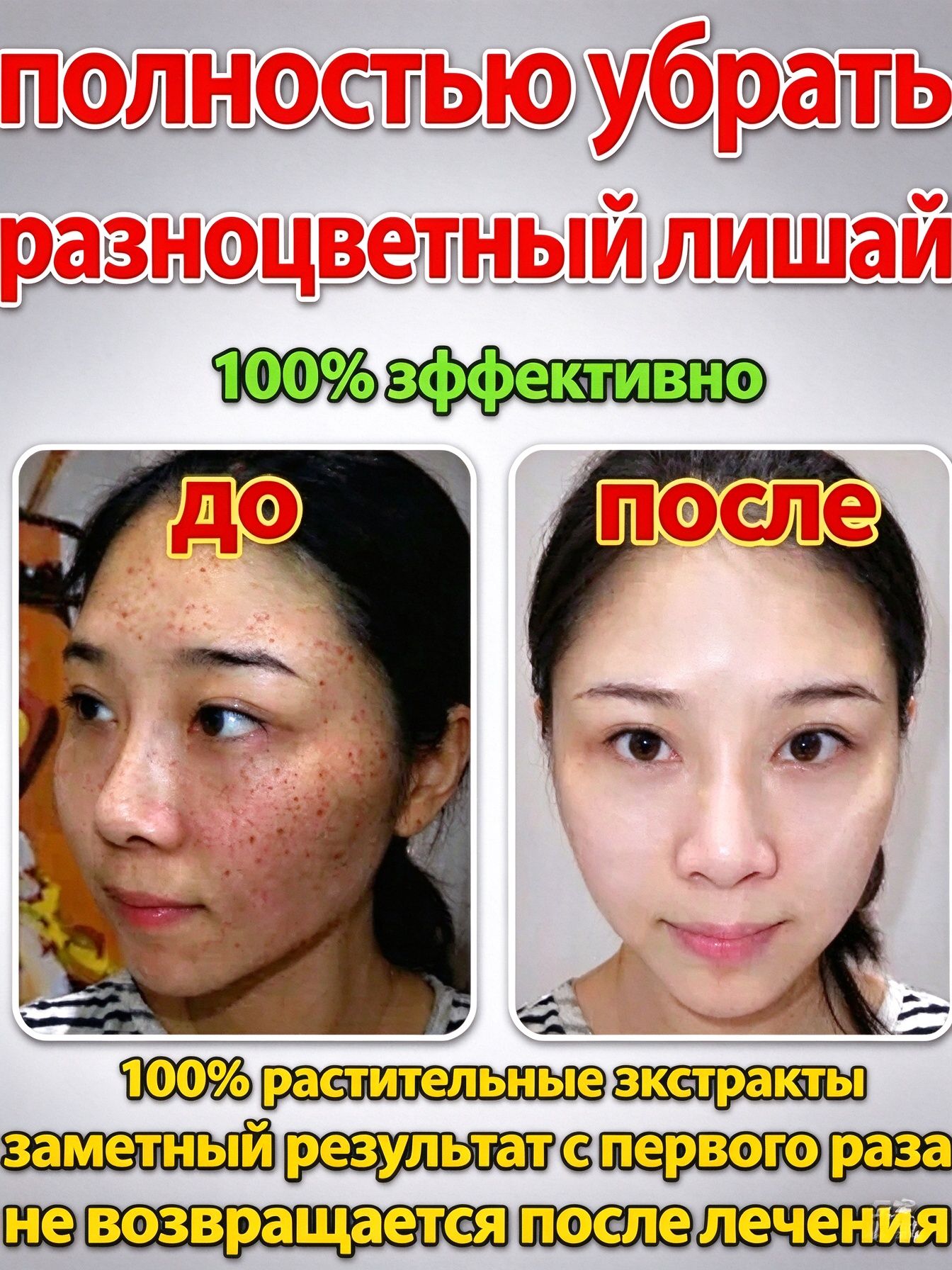 Белые пятна? Крем для выравнивания тона и улучшения пигментации