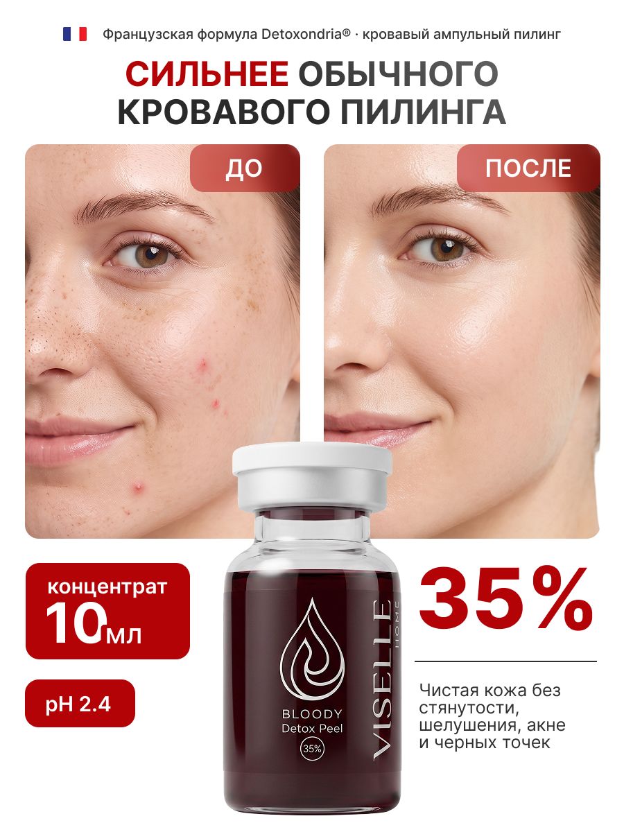 Кровавый пилинг для лица кислотный VISELLE от прыщей AHA/BHA