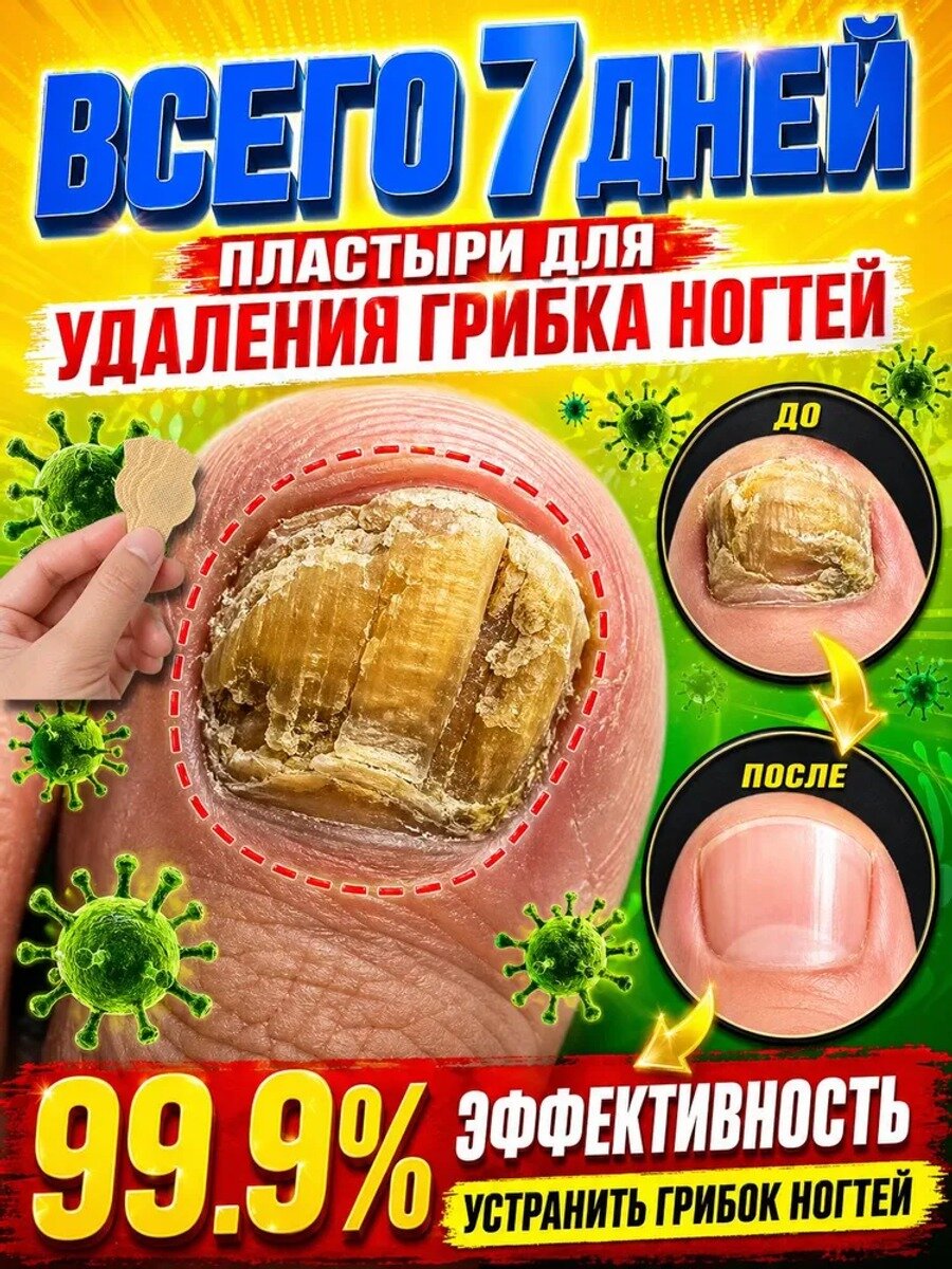 Know EasyxНаклейки для у x ода за ногтями для лечения плесневы x инфекций укрепления ногтей