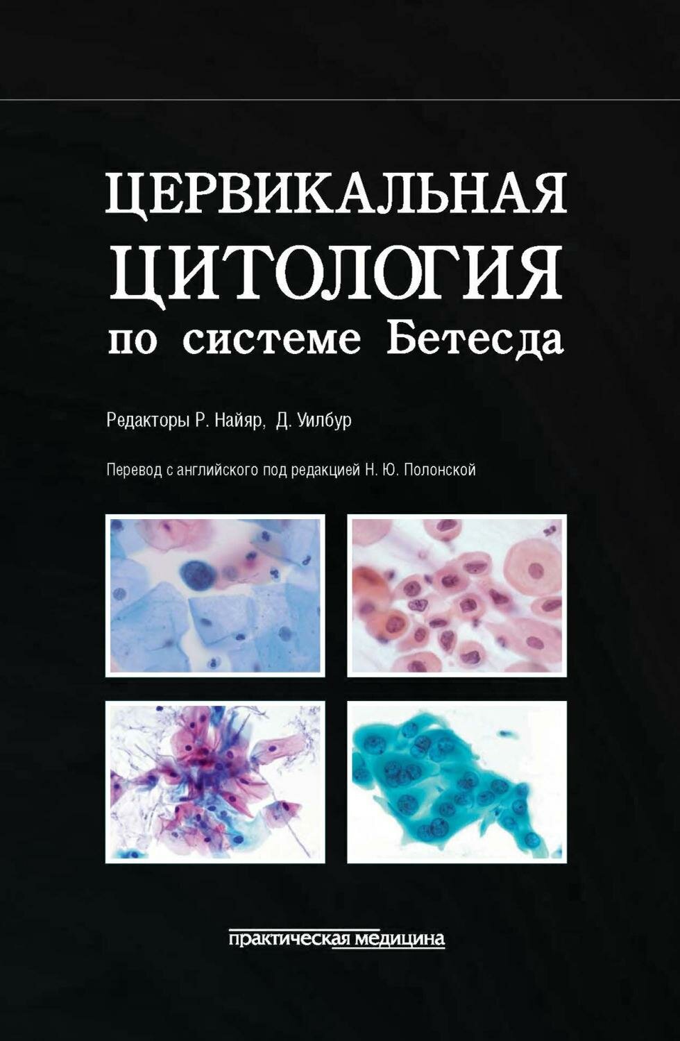 Цервикальная цитология по системе Бетесда. Терминология, критерии и пояснения