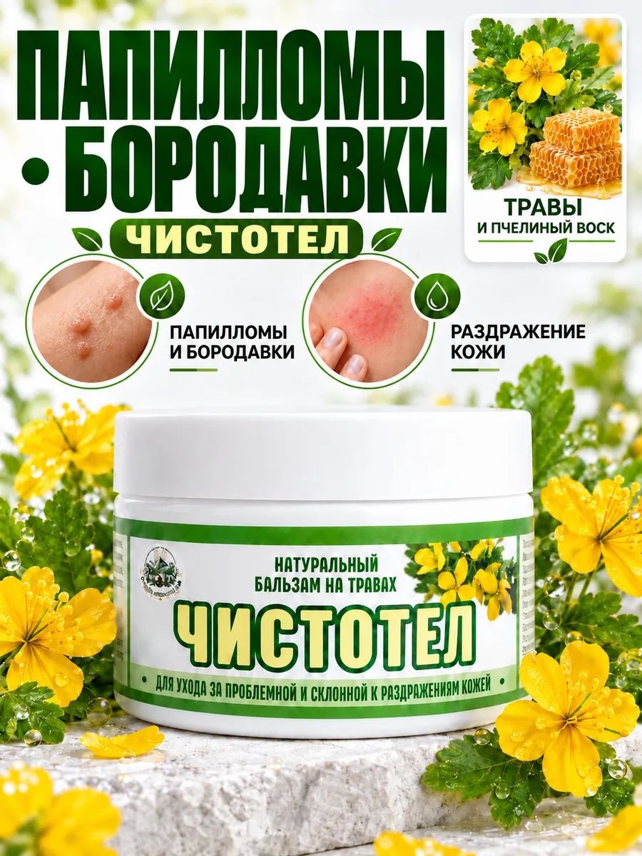 Мазь Чистотел от папиллом и бородавок, прыщей, акне, псориаза, дерматита, экземы и грибка кожи