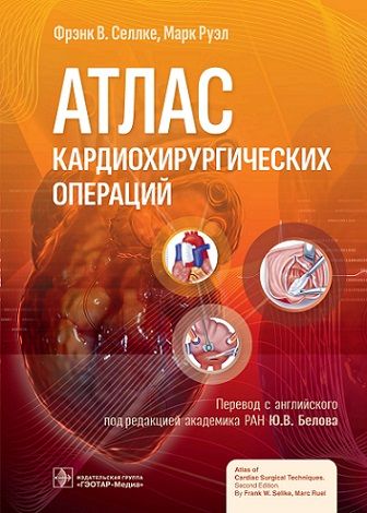 Атлас кардиохирургических операций