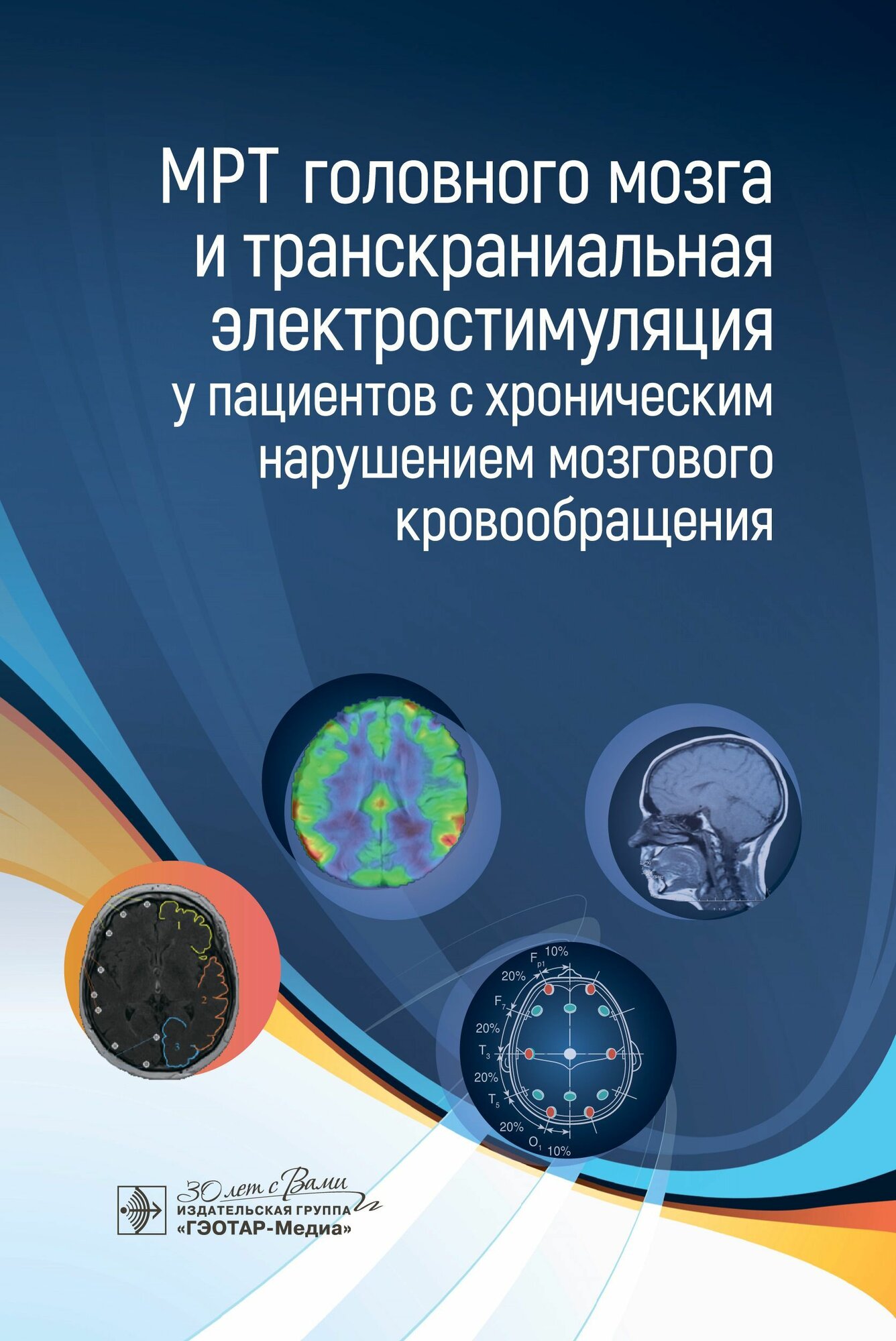 МРТ головного мозга и транскраниальная электростимуляция у пациентов с хроническим нарушением мозгового кровообращения