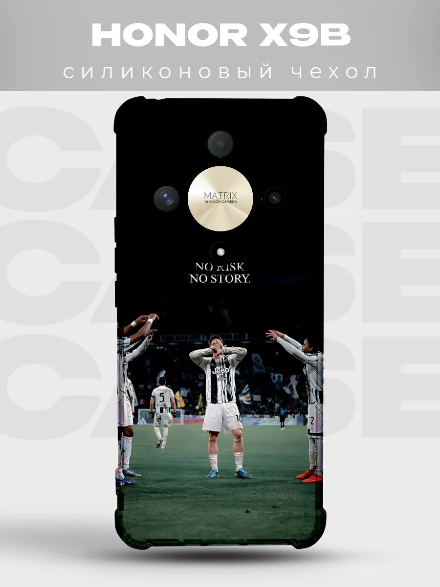 Чехол на Honor X9B Дибала Ювентус