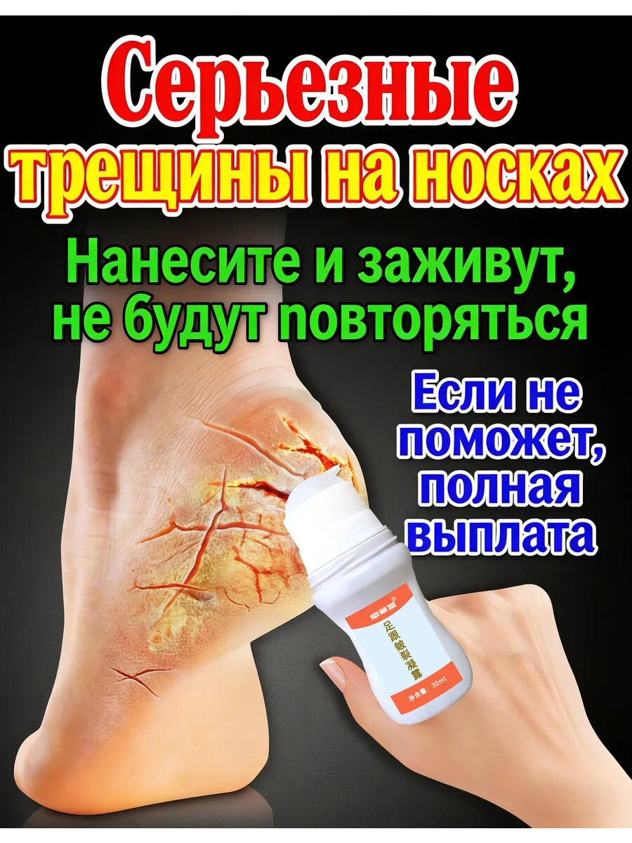 Крем с мочевиной для ног от трещин 50%