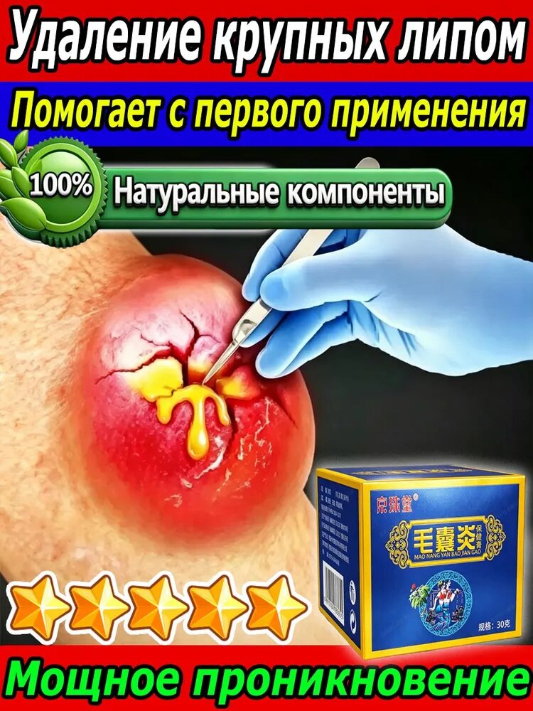 Мазь от липомы и жировиков 30 г Лечебный уход