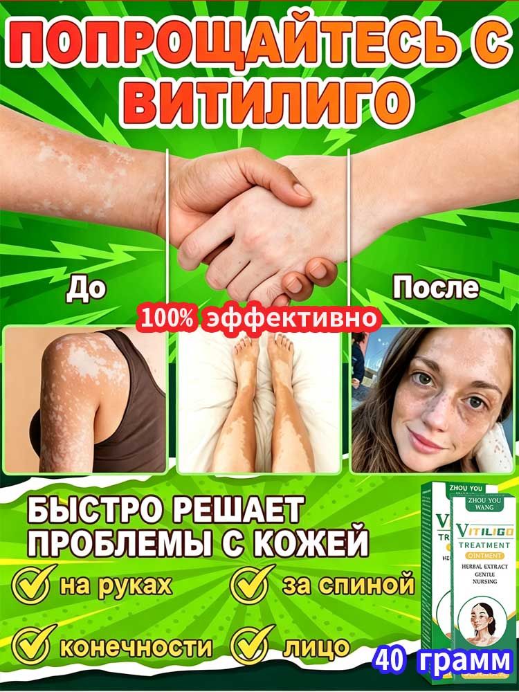 Мазь для лечения витилиго, эффективно удаляет белые пятна и регулирует пигментацию, выравнивает тон кожи и устраняет странные взгляды окружающих, 100 грамм