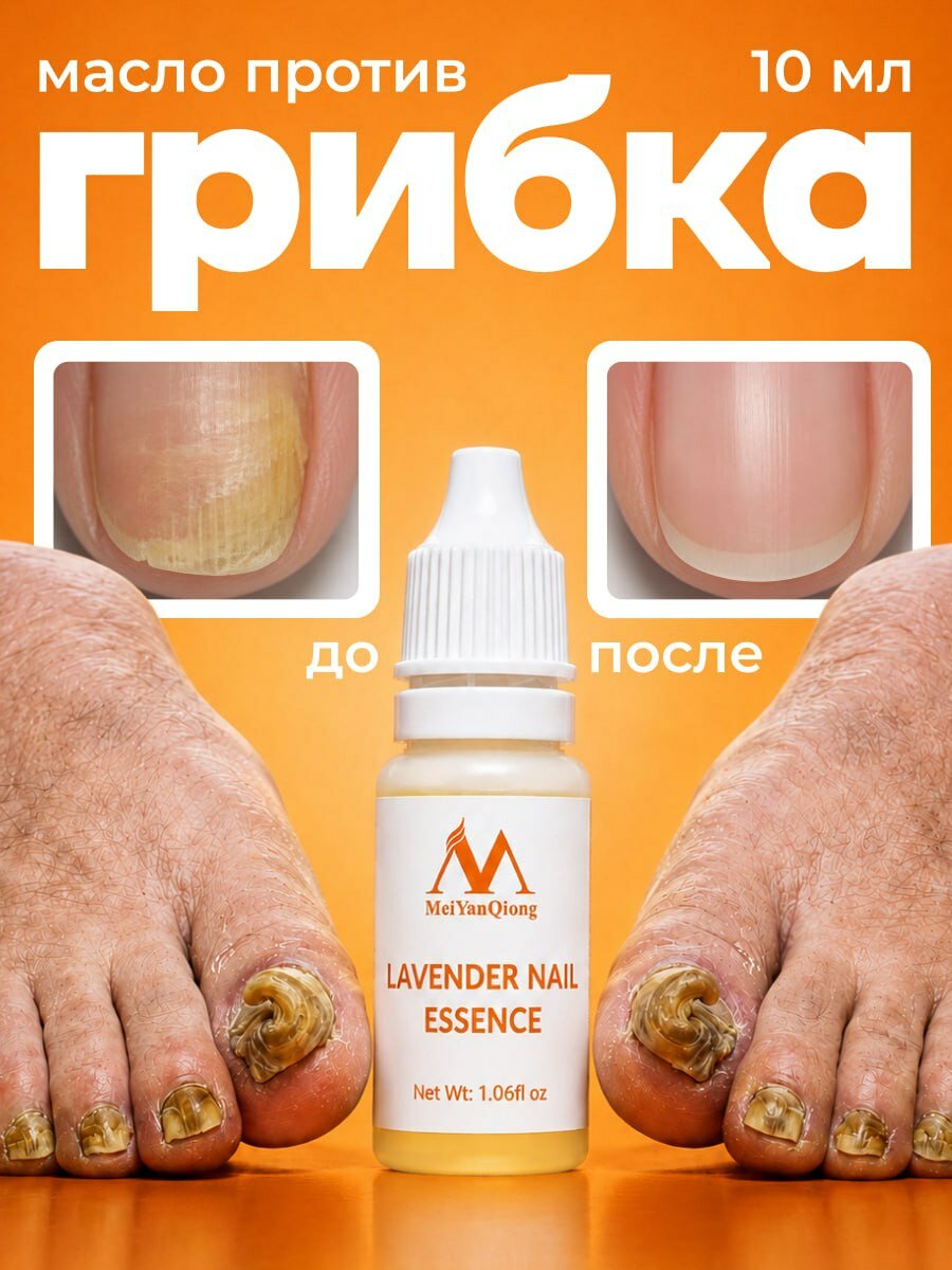 Эффективное масло для ухода за ногтями на ногах и руках, Lavander, 10 мл, стоп онихолизис для ухода за ногтями и педикю