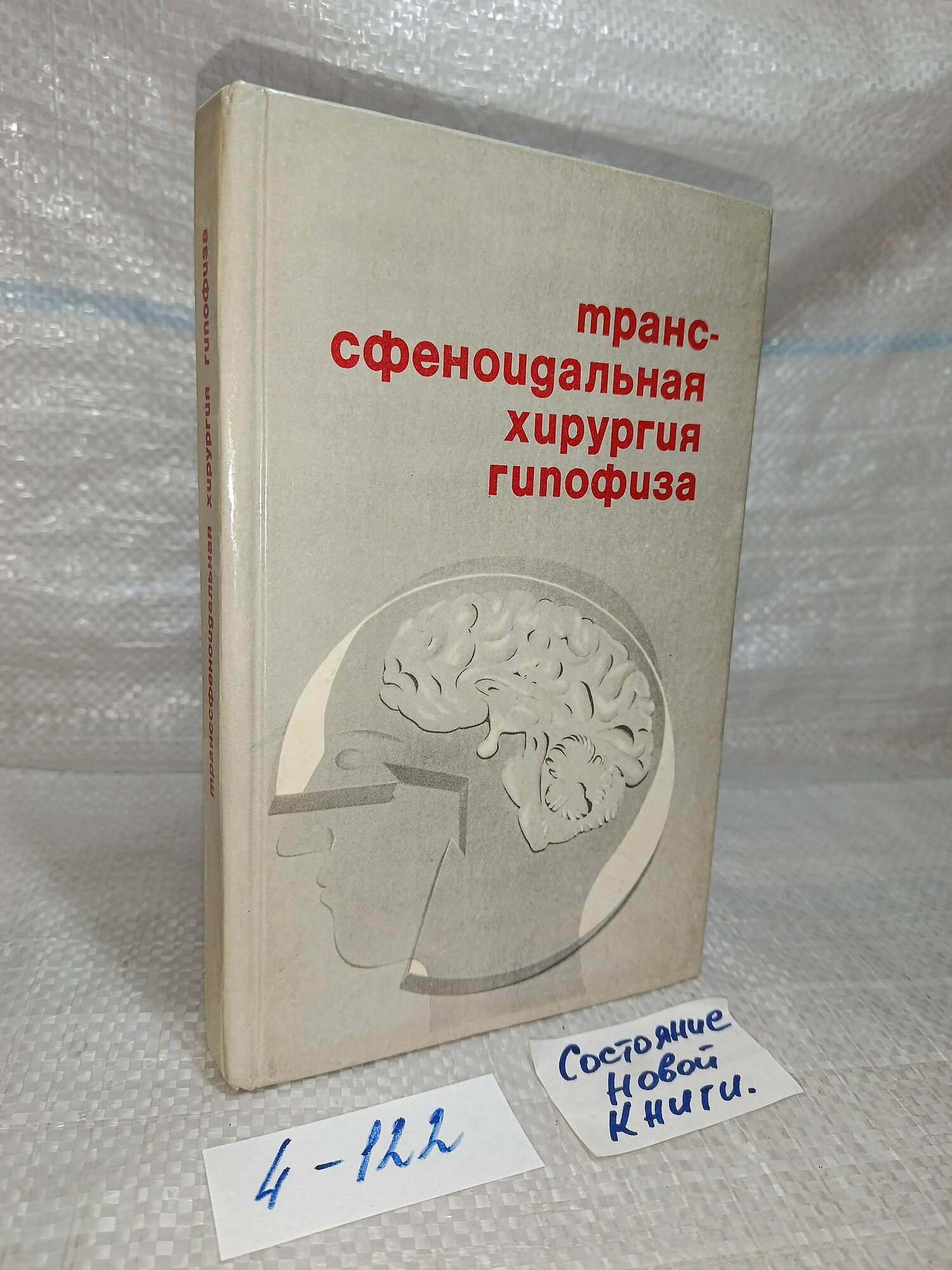 Трансфеноидальная хирургия гипофиза. Под ред. А. Арутюнова.