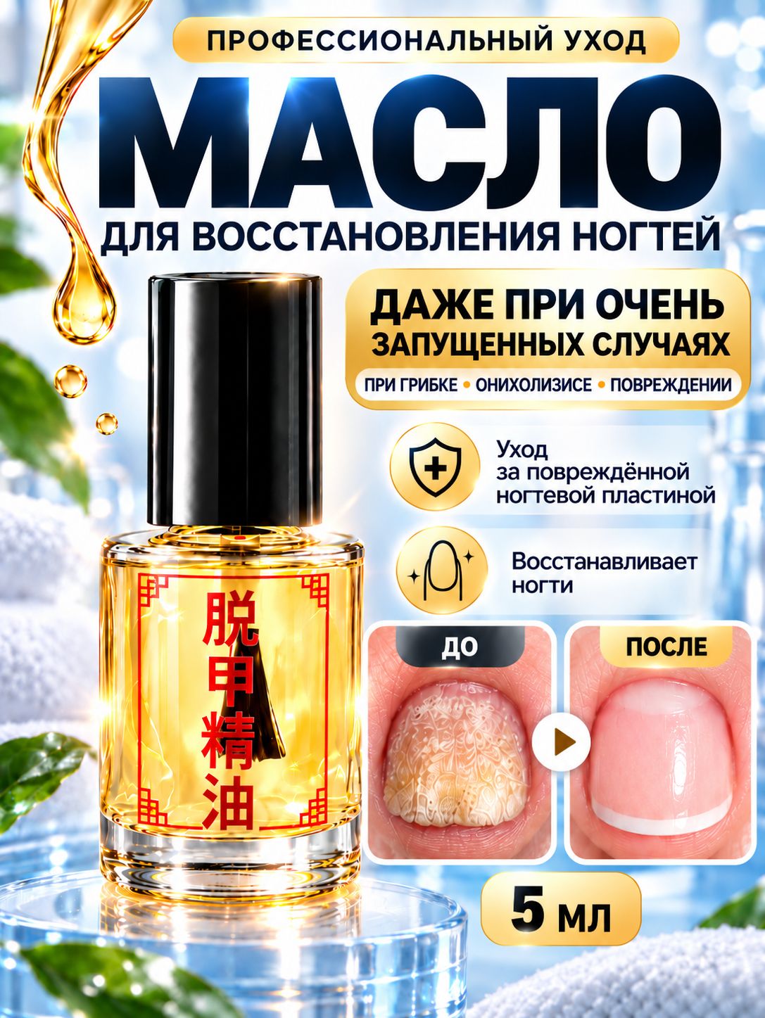 Масло монарды от грибка ногтей и онихолизиса, противогрибковое средство для восстановления ногтей с чайным деревом, 5 мл