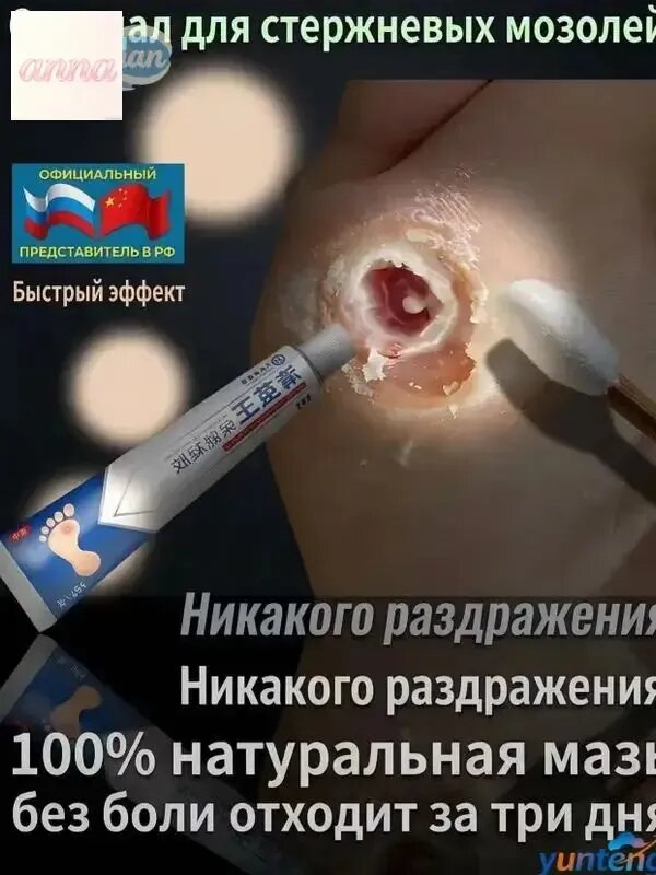 Средство от шипиц, натоптышей и сухих стержневых мозолей на ногах мазь и гель Корнекс, эффективное китайское средство