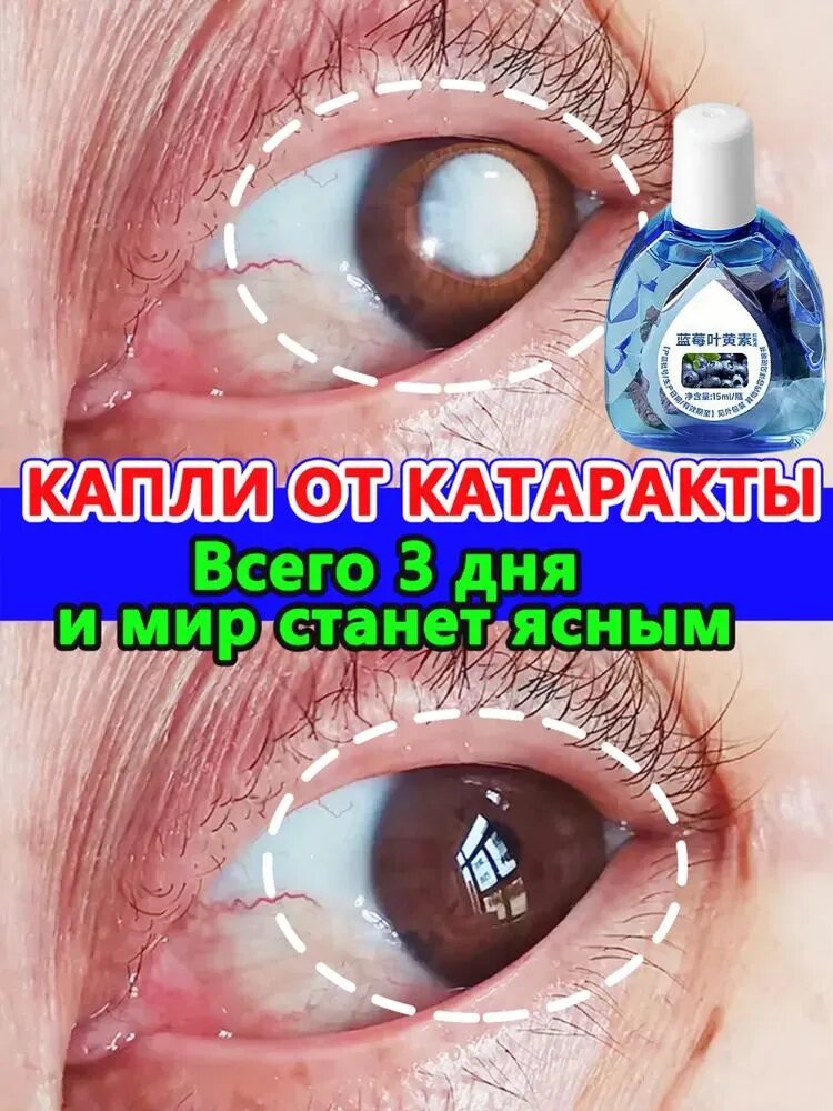 Капли от дальнозоркости Чин Жэ Ду по традициям Китая 15 мл