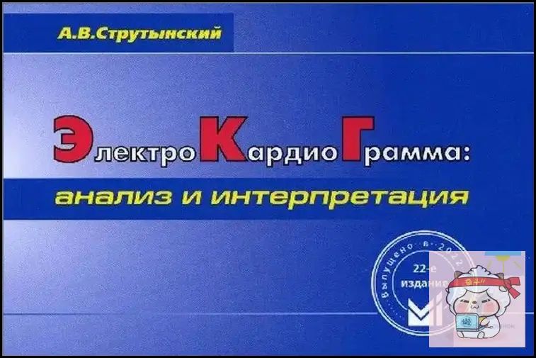Электрокардиограмма. Анализ и интерпретация
