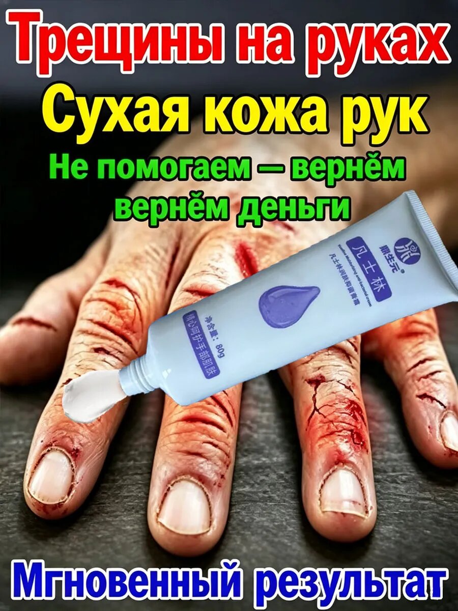 Уродерм с мочевиной 30% для пяток крем