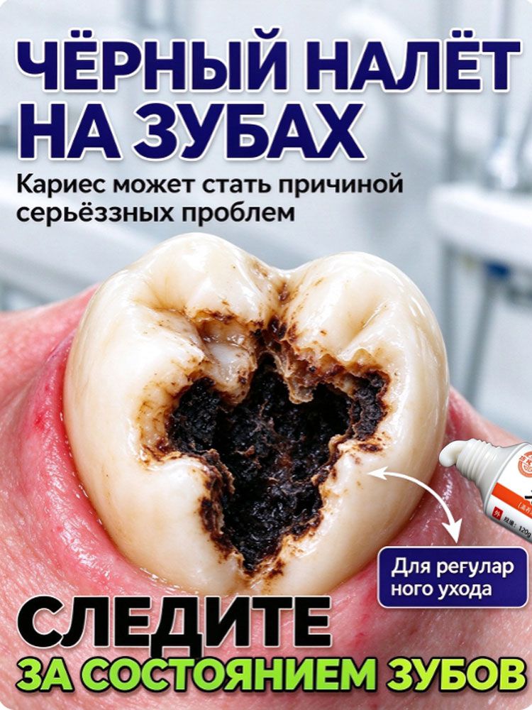 Профилактический зубной гель от кариеса, средство для домашнего ухода за полостью рта