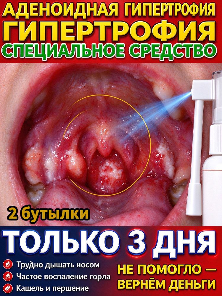Спрей премиумкласса на травах для горла, применяемый при хроническом тонзиллите и фарингите, снимает зуд, першение и болевой дискомфорт, раздражение слизистой не провоцируется.