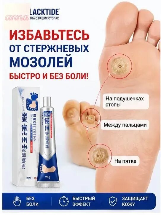 Средство от шипиц, натоптышей и сухих стержневых мозолей на ногах мазь и гель Корнекс, эффективное китайское средство