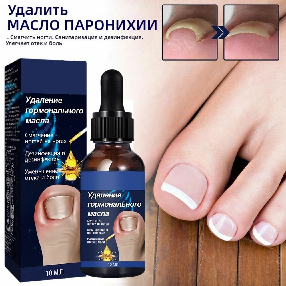 10 мл эфирное масло для лечения грибка ногтей на ногах, уход за лечением онихомикоза