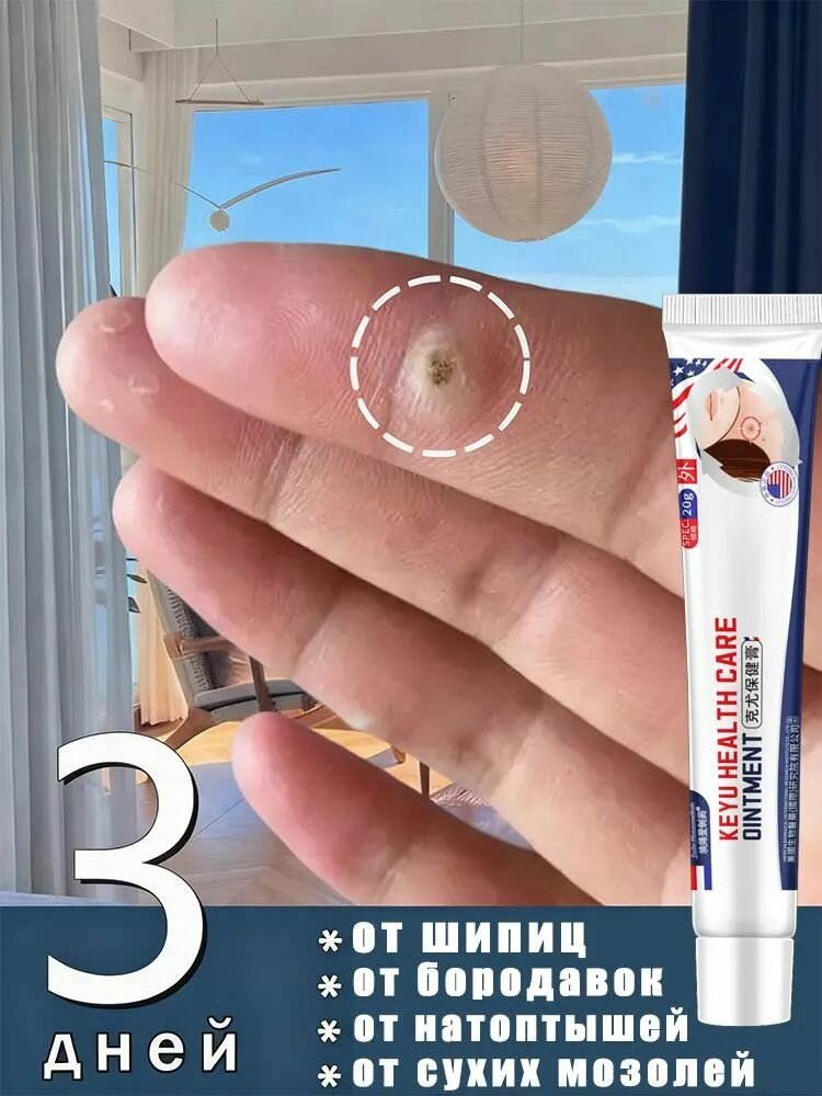 Колломак от бородавок и папиллом, эффективного удаления бородавок и папиллом на лице, теле, руках и ногах. Без боли, без следов, без побочных эффектов.