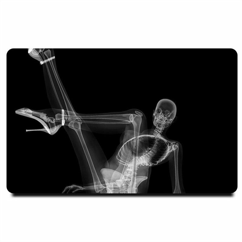 Магнит на холодильник "Эротическое фото через рентген"