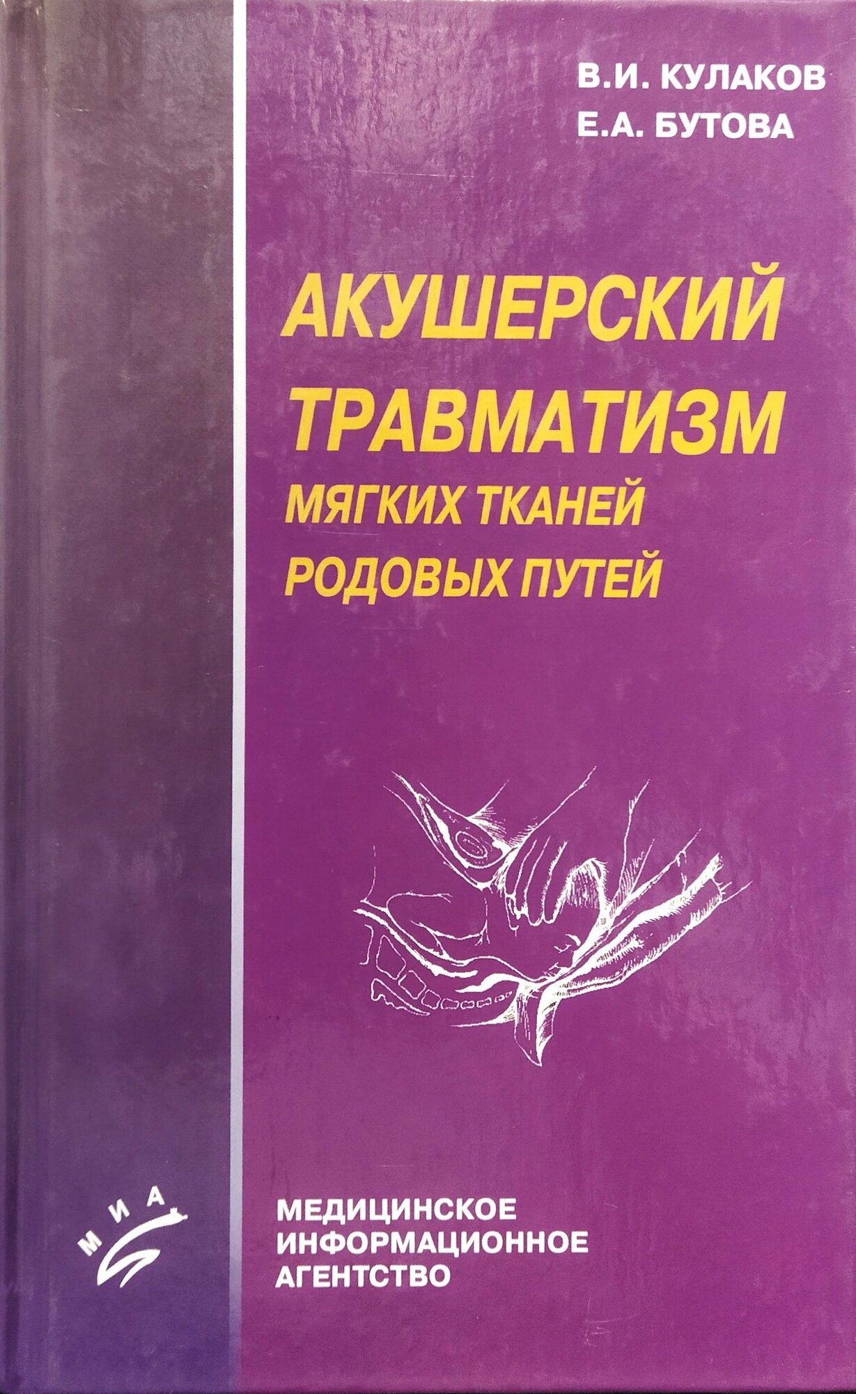 Акушерский травматизм мягких тканей родовых путей