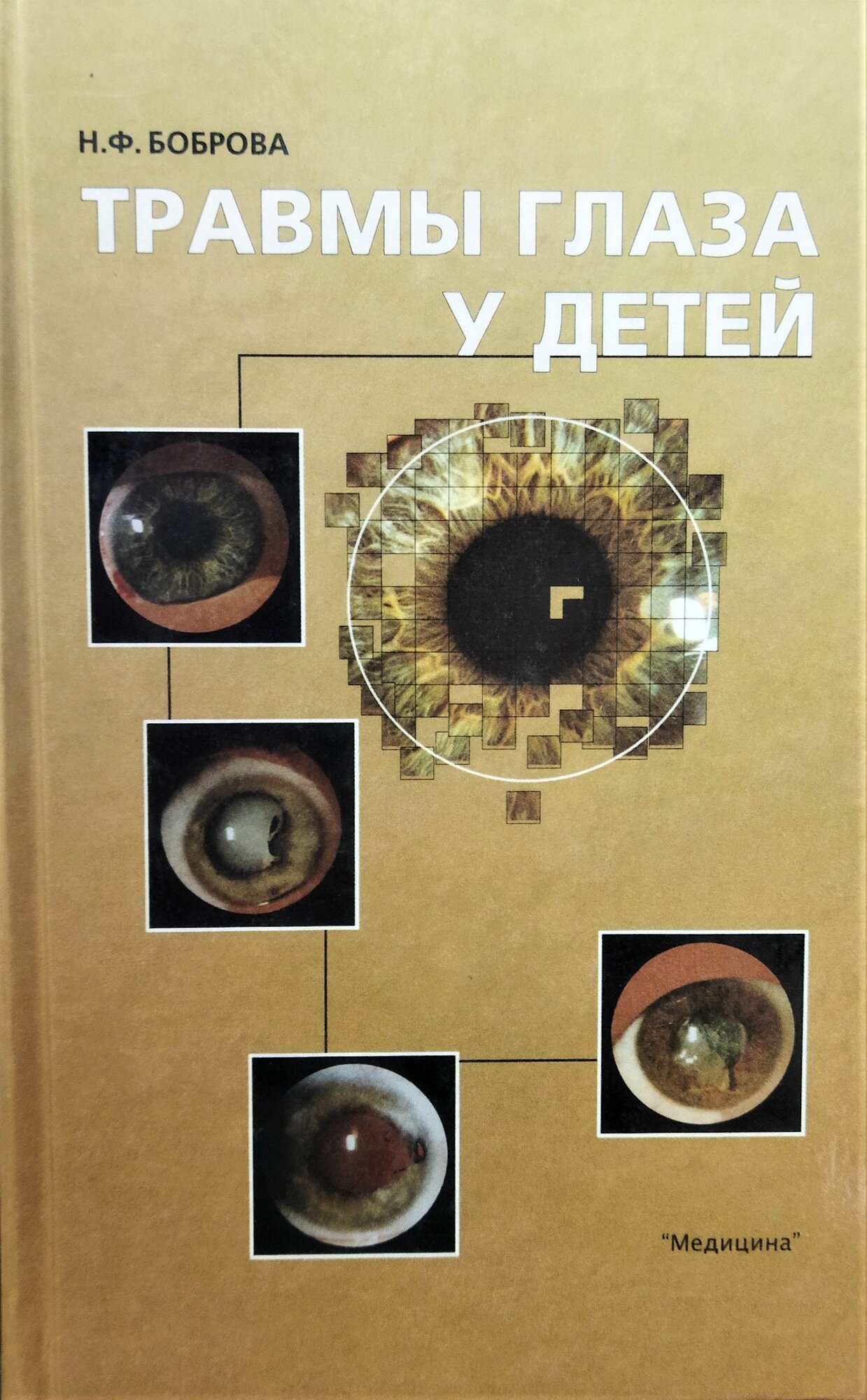 Травмы глаза у детей