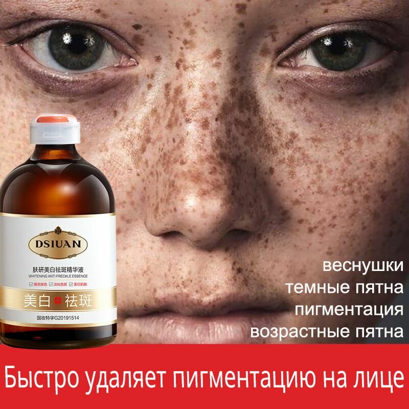 Сыворотка для лица с ниацинамидом, пигментации Сущность для лица отбеливающий, для удаления веснушек, пигментных пятен, черное пятно / 15мл