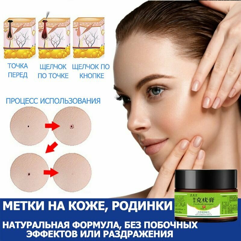 Крем от бородавок, Крем-гель от бородавок и папиллом, 20 г