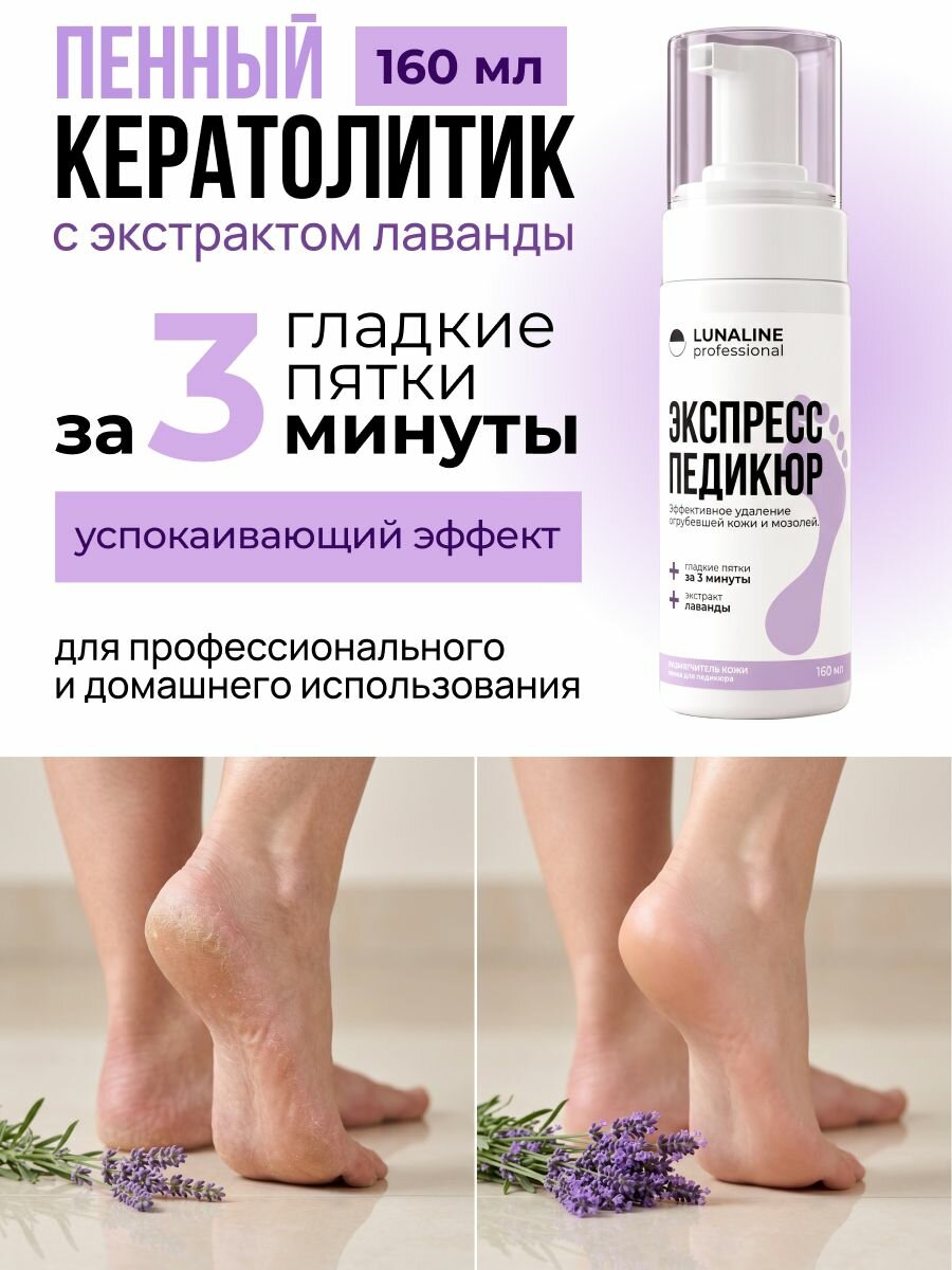 Кератолитик пенка для пяток и педикюра, профессиональный Размягчитель кожи 160 мл