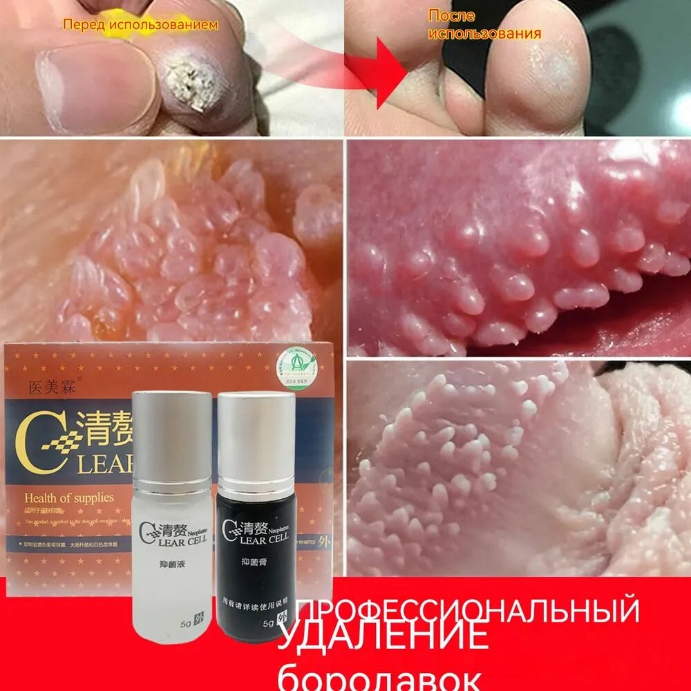Лечебное средство — фото 1