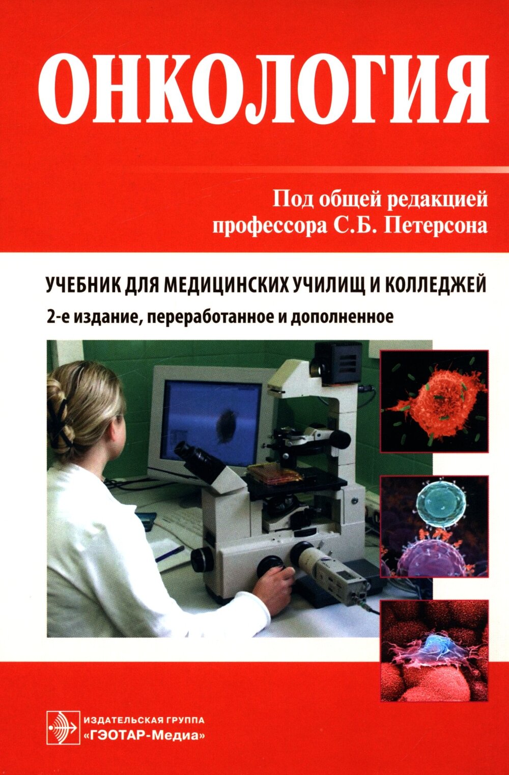 Онкология. Учебник. 2-е изд, перераб. и доп. Под ред. Петерсона С. Б. Гэотар-медиа