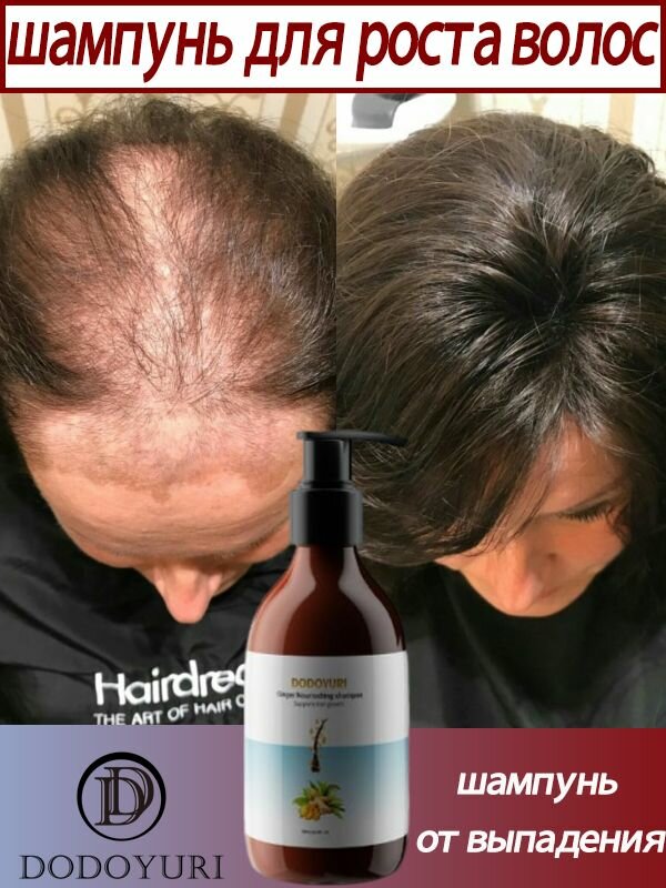 Укрепляющий шампунь против выпадения волос, средство от облысения алопеции, активатор роста для густоты волос, 300 мл
