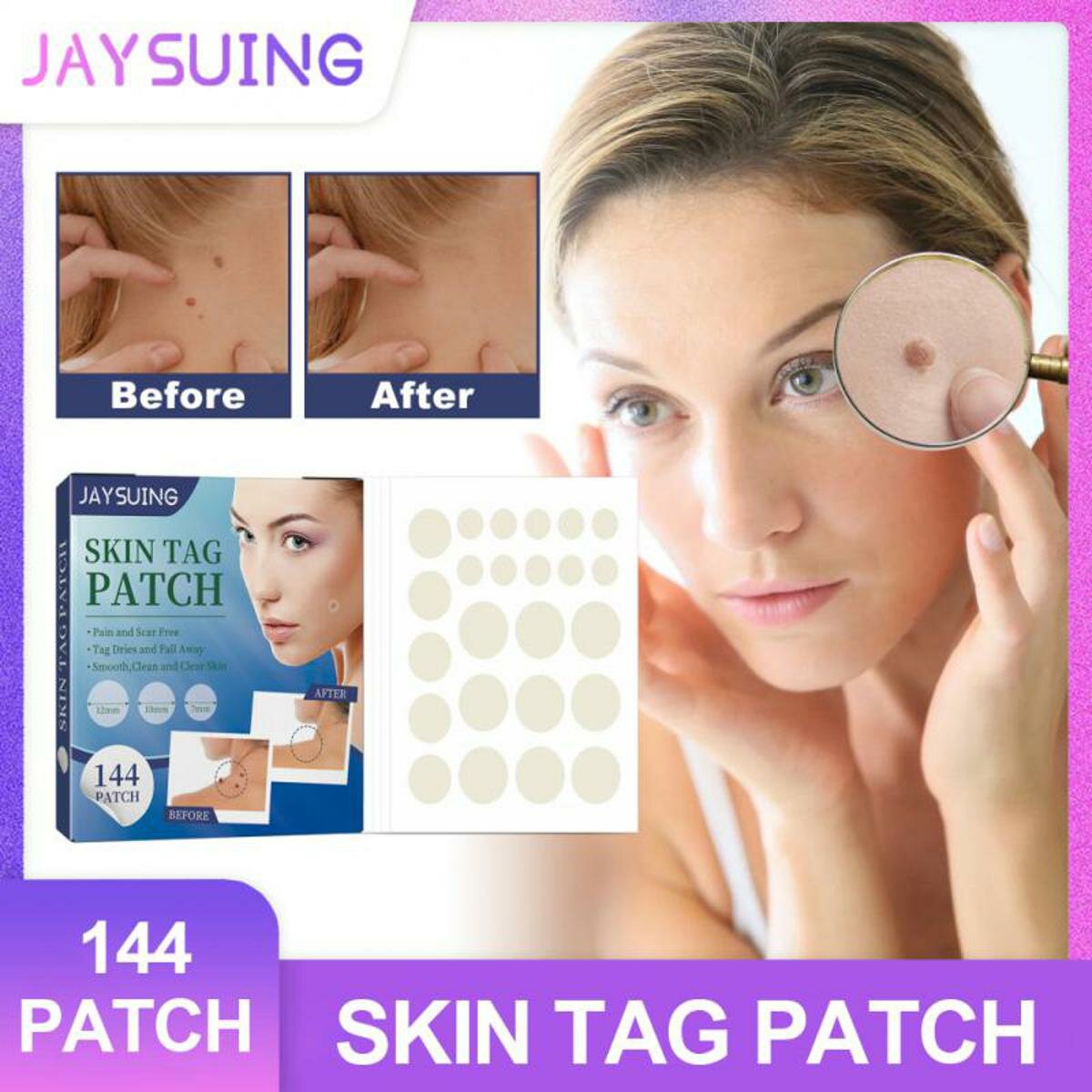 144/180 шт, патчи для удаления бородавок, набор средств для лечения бородавок, экстракт трав, этикетки для кожи, средства для удаления акне, бородавок, наклейки для ухода за кожей