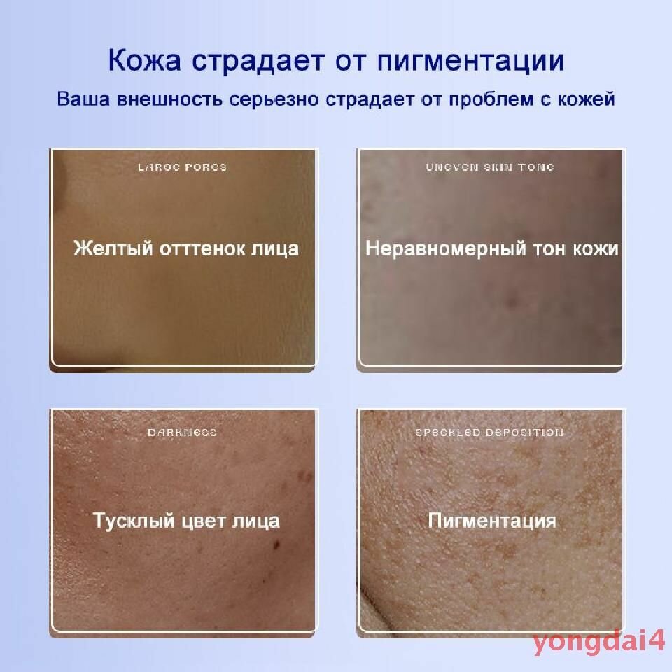 377 Отбеливающий крем для лица пигментные пятна на лице 30 мл против пигментации Отбеливающий крем для лица от пигментных пятен и веснушек