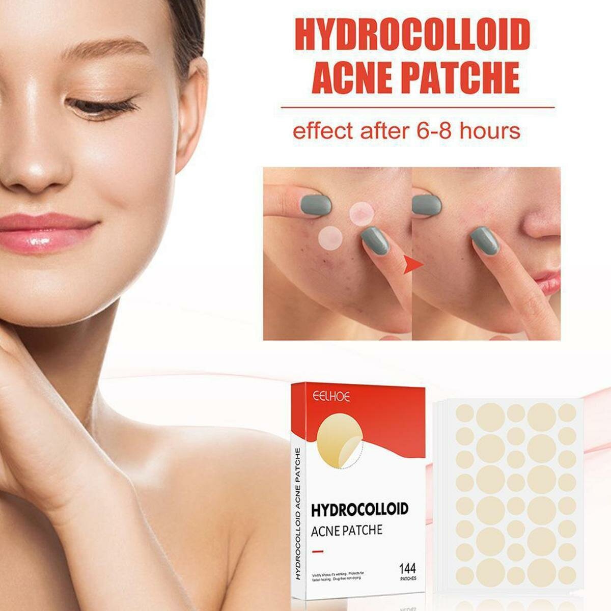 144 шт, пластырь для удаления прыщей, крем для удаления прыщей, маска для удаления угрей, инструмент для удаления прыщей, черный прыщ, шрам на коже, бирка