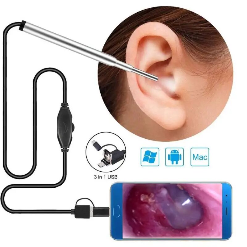 XGKHUT USB эндоскоп для ушей Silver